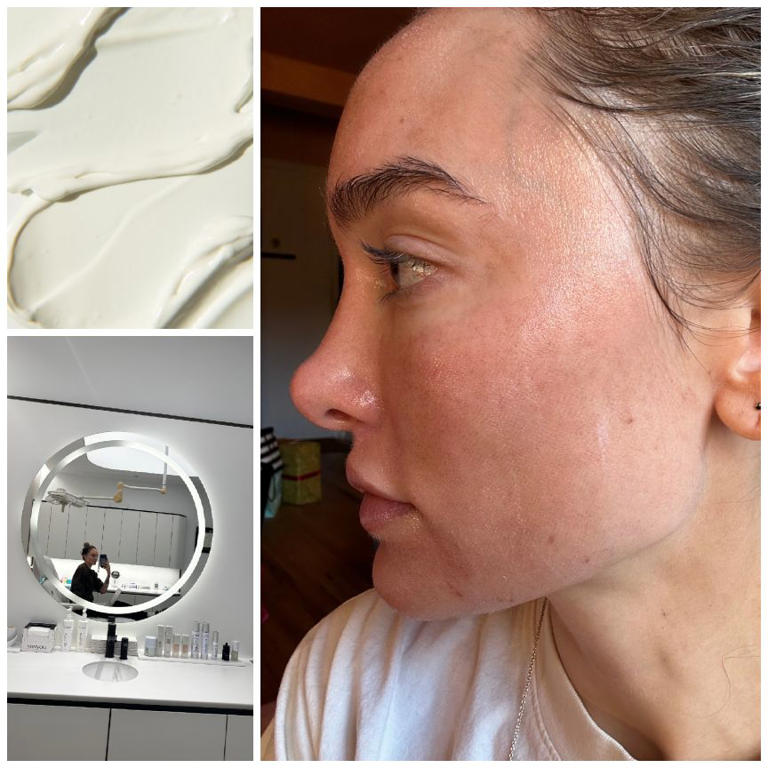 It’s laser season—but good after-care is the key to results