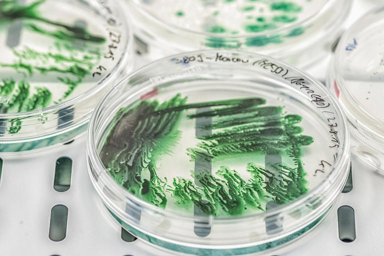 Cyanobacteria can utilize toxic guanidine as a nitrogen source