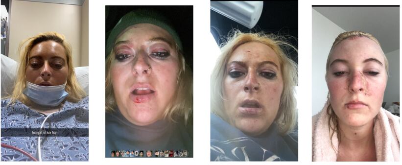 Death of Nashville woman prompts bill to ban sale of nitrous oxide