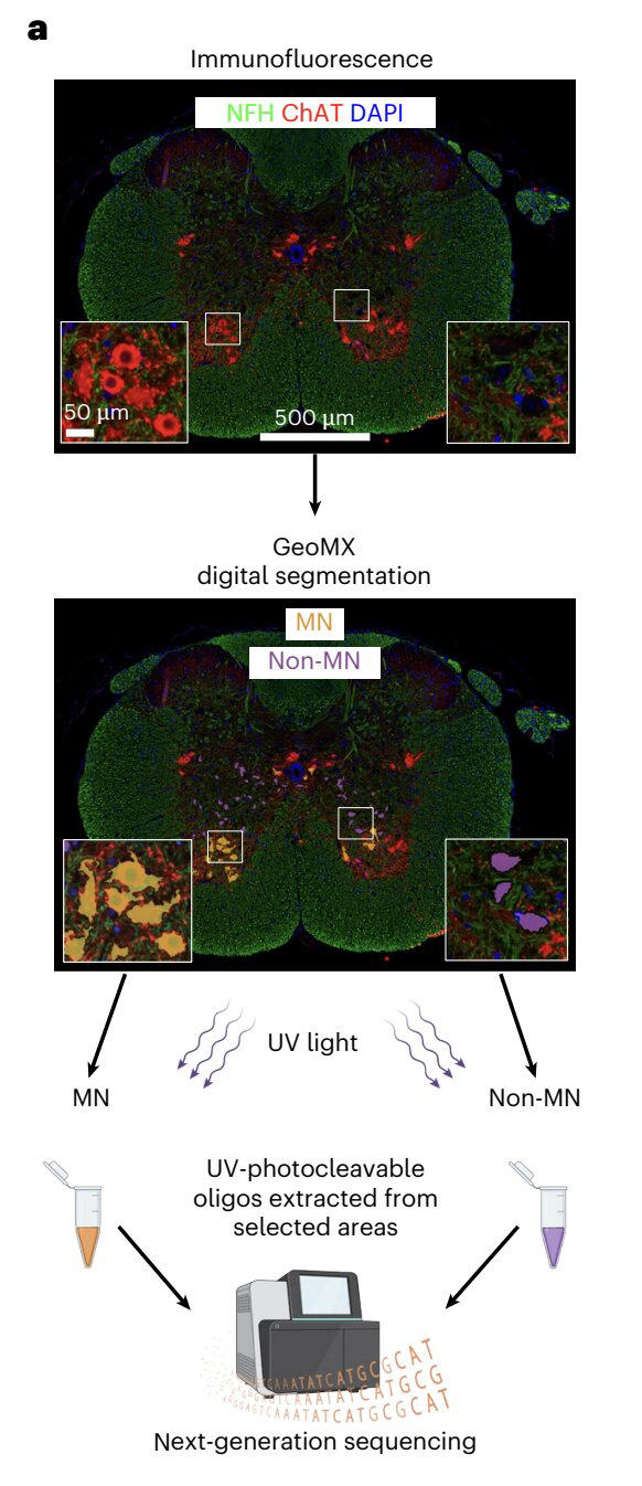 A closer look at how local protein production is altered in ALS
