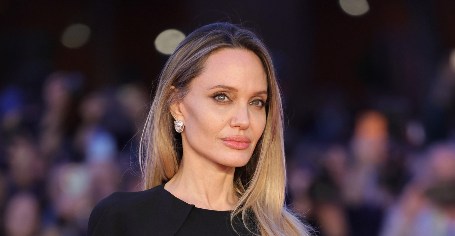 Stars who suffer from rare diseases