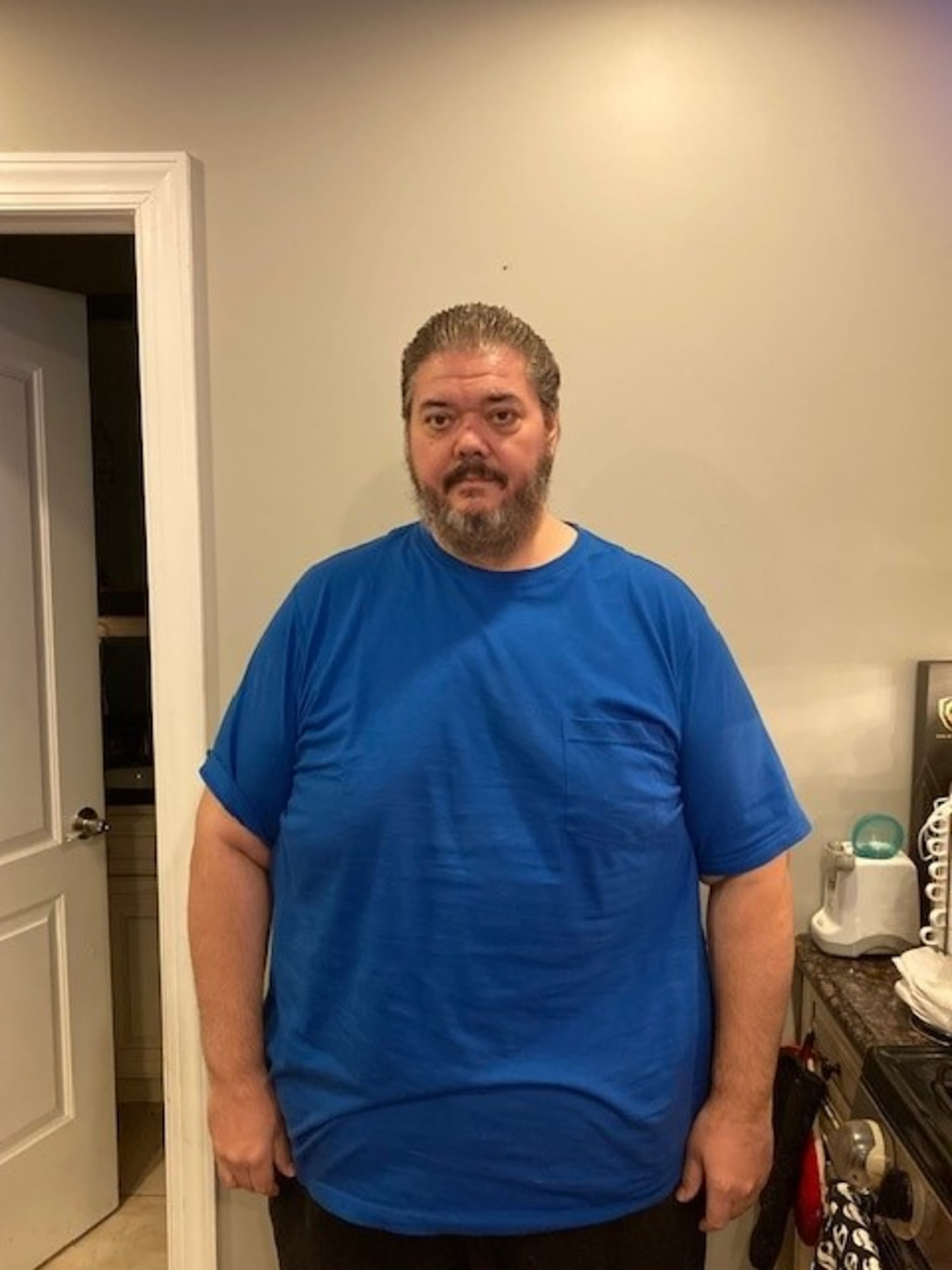 Man who lost more than 300 pounds reveals the 1 lifestyle change he's ...