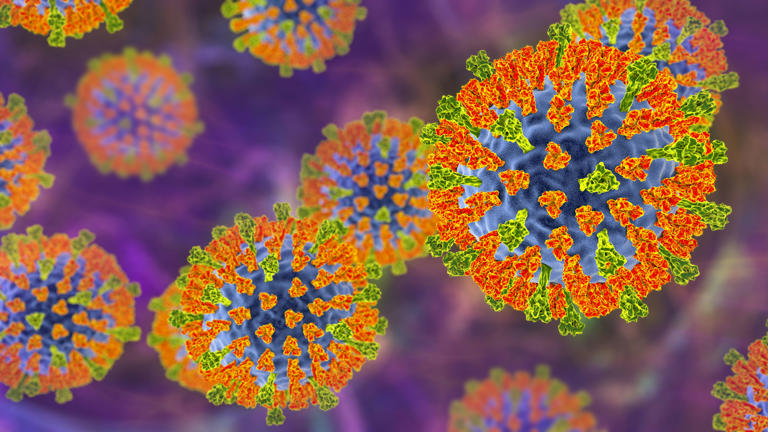 Measles case reported in Northern Virginia child. Check potential ...