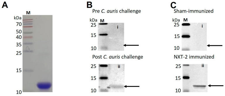 Pan-fungal vaccine proves effective against Candida auris in mice