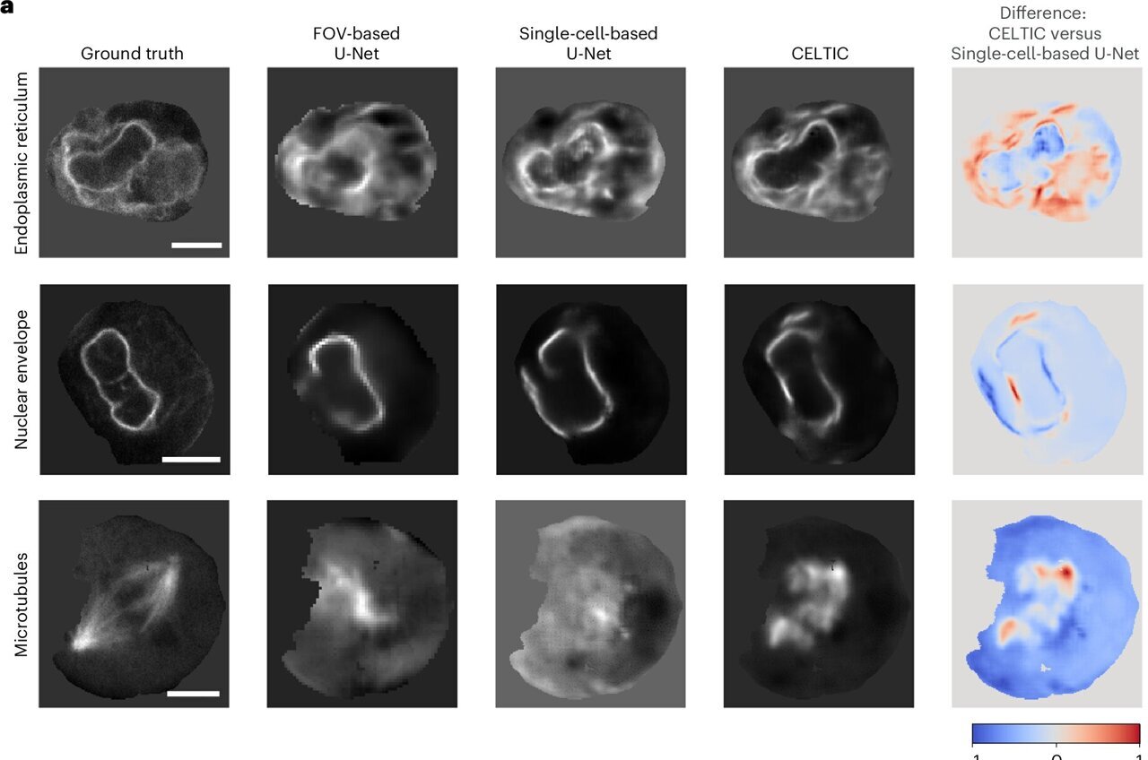 Virtual staining advances: AI uses cell context to improve imaging accuracy