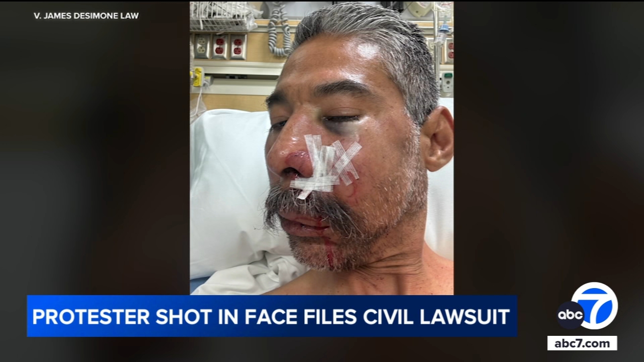 Protester shot in face with foam projectile during anti-ICE protest ...
