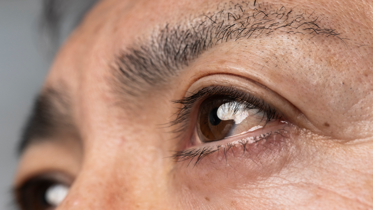 Color blindness linked to lower bladder cancer survival, early study hints