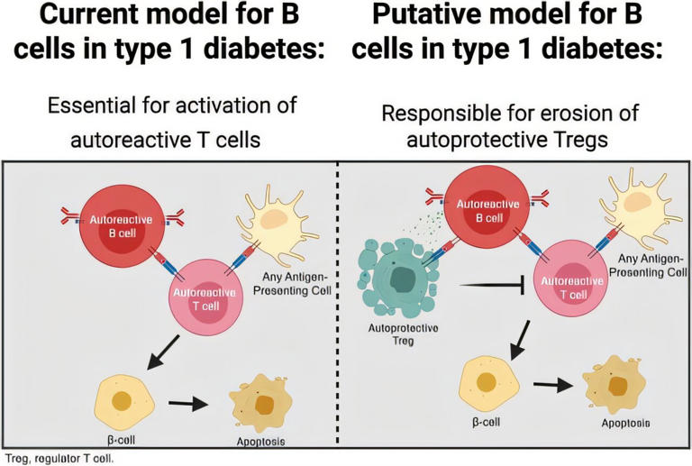 B cells play a more sinister role than believed in progression of type ...