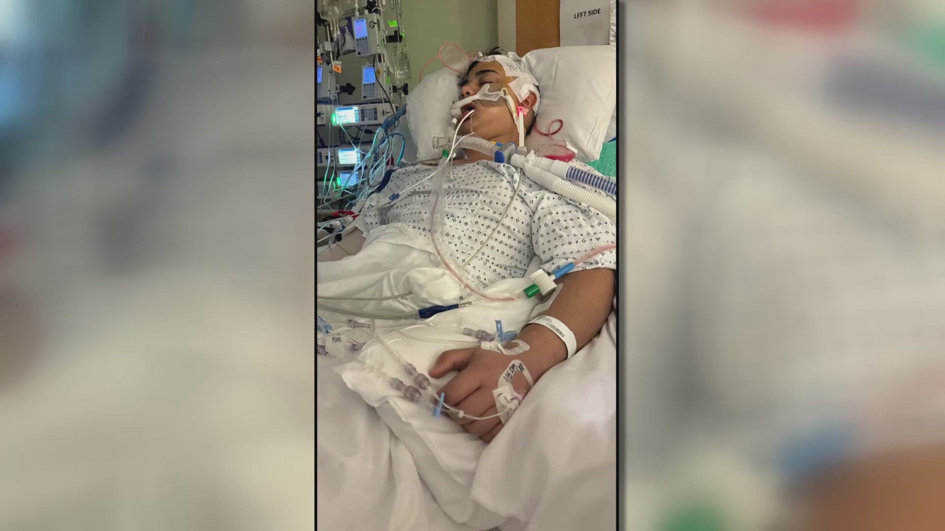 15-year-old Afghan refugee fighting for life after crash