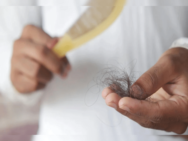 Hair fall test: How to find out if hair fall is normal or if it's due ...