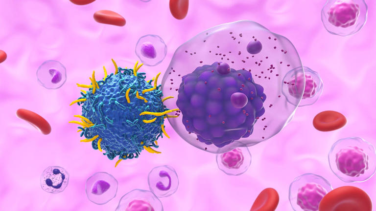 CAR-T immune toxicity linked to non-relapse mortality risk in myeloma