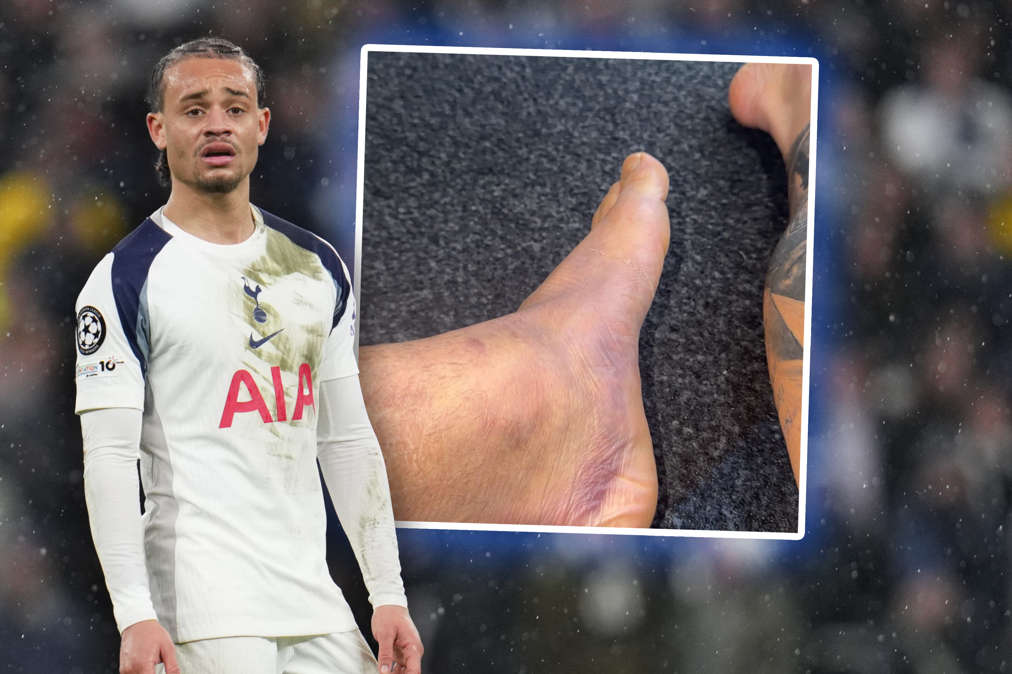 Xavi Simons deelt foto van gezwollen voet na CL-zege op Dortmund