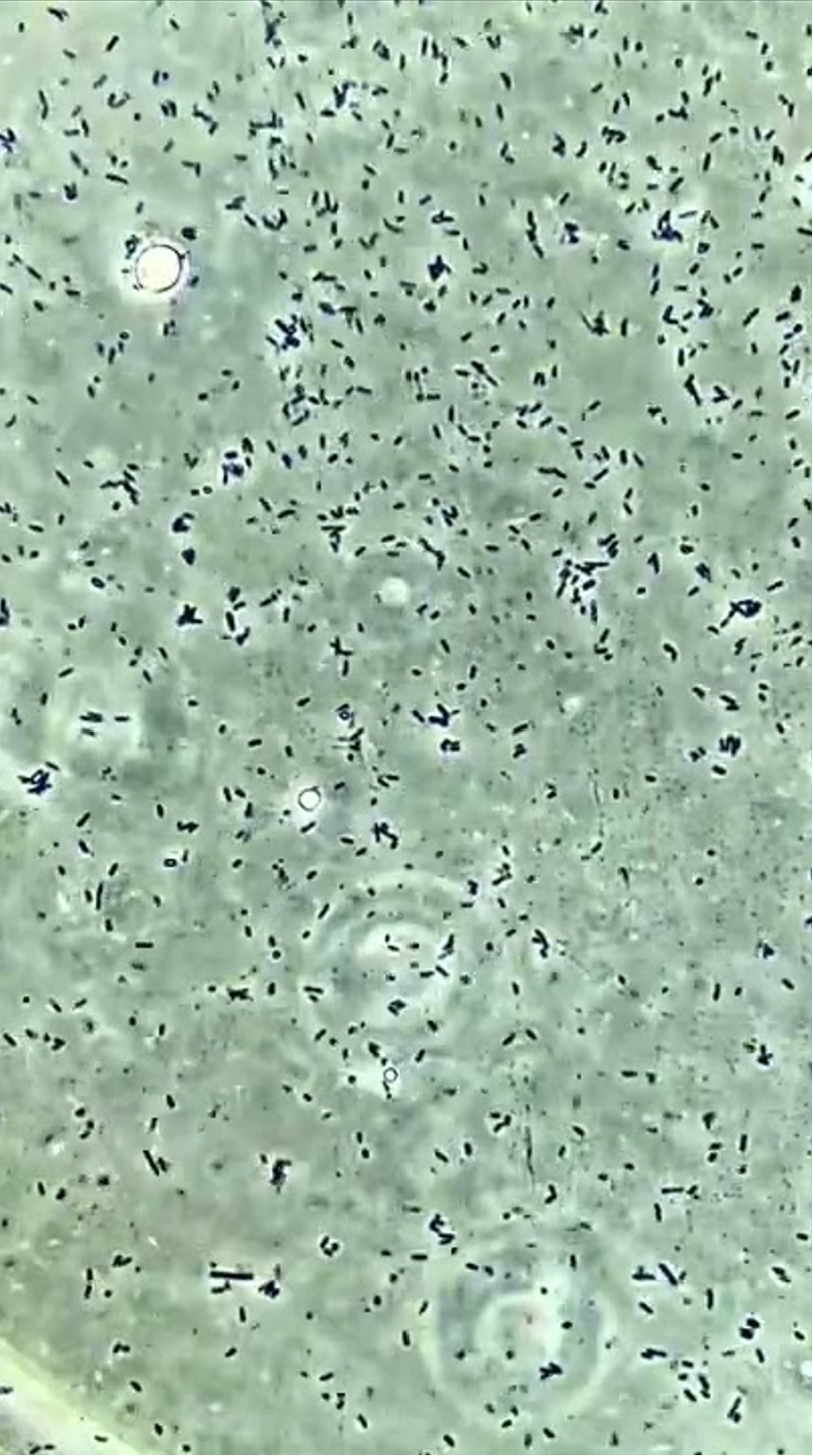 Bacteria versus caustic soda under the microscope!