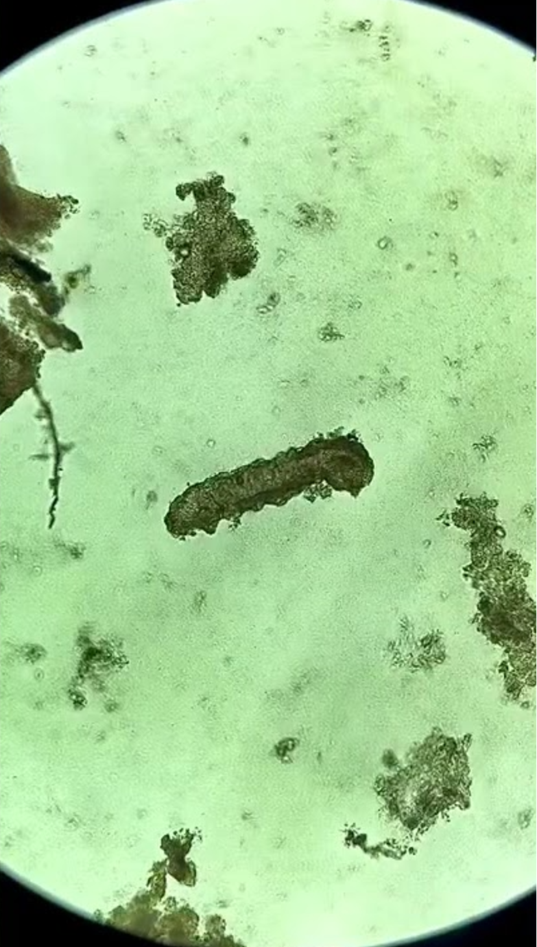 Pink mold under the microscope!