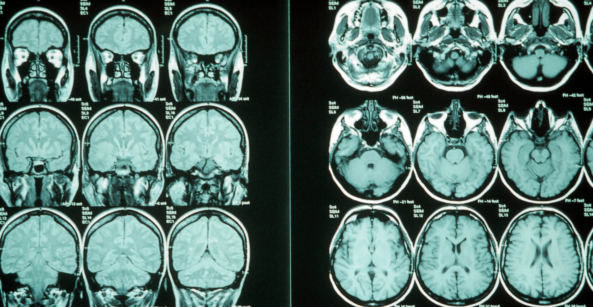 ¿Qué parte del cerebro utilizamos realmente?