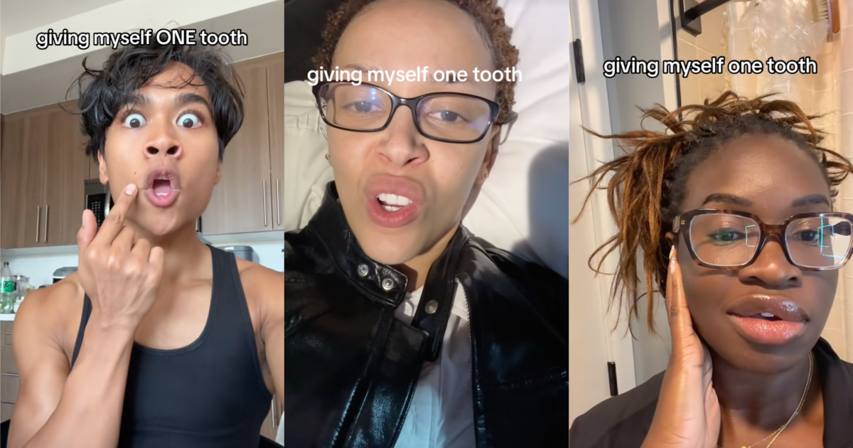The “One Tooth” Trend Is Yet Another Strange Phenomenon TikTokkers Are ...
