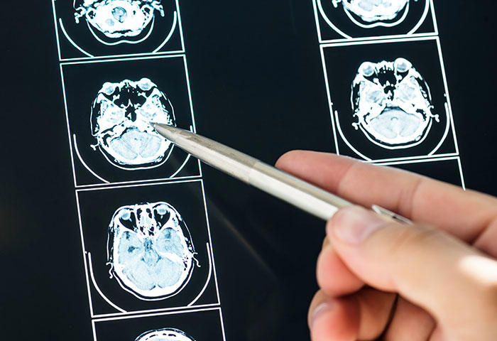 36 diseases that are the worst of the worst