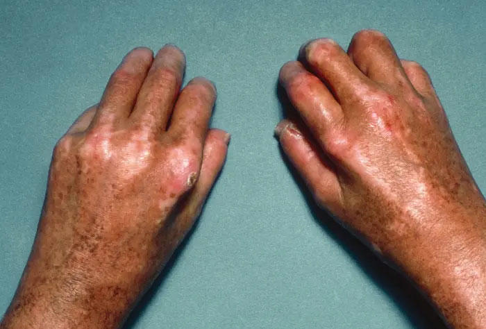 36 diseases that are the worst of the worst