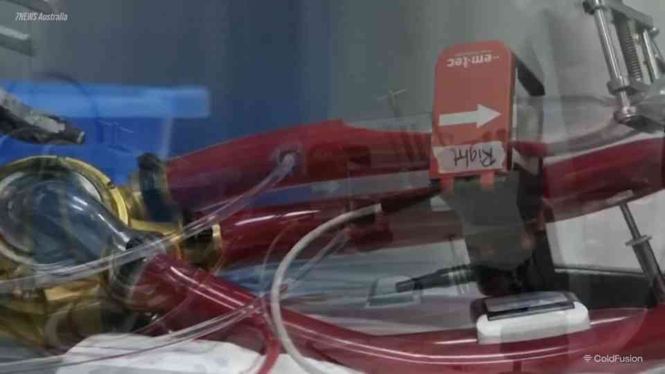 New artificial heart saved a life - this is the future of heart failure