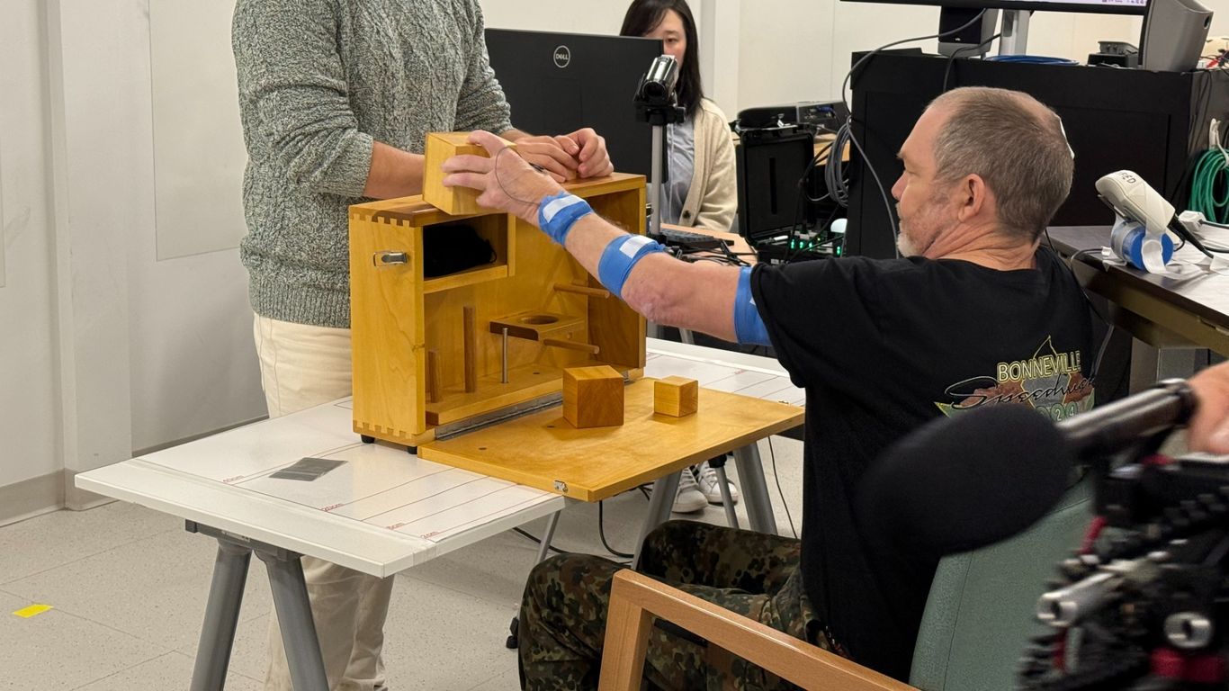 Early trial finds brain stimulation could boost stroke recovery