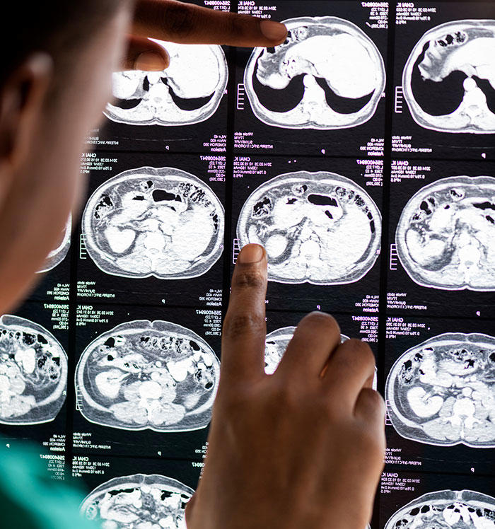 36 diseases that are the worst of the worst