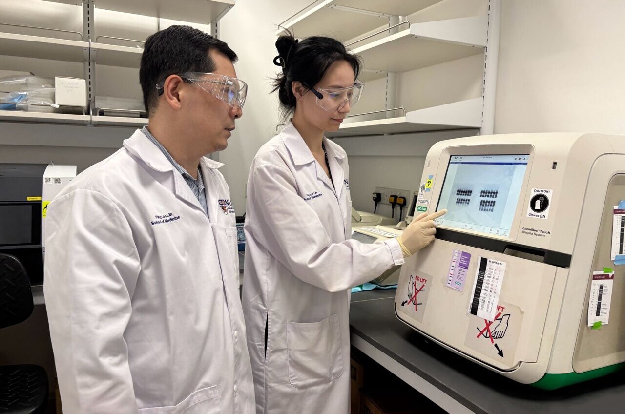 Key protein can restore aging neural stem cells' ability to regenerate