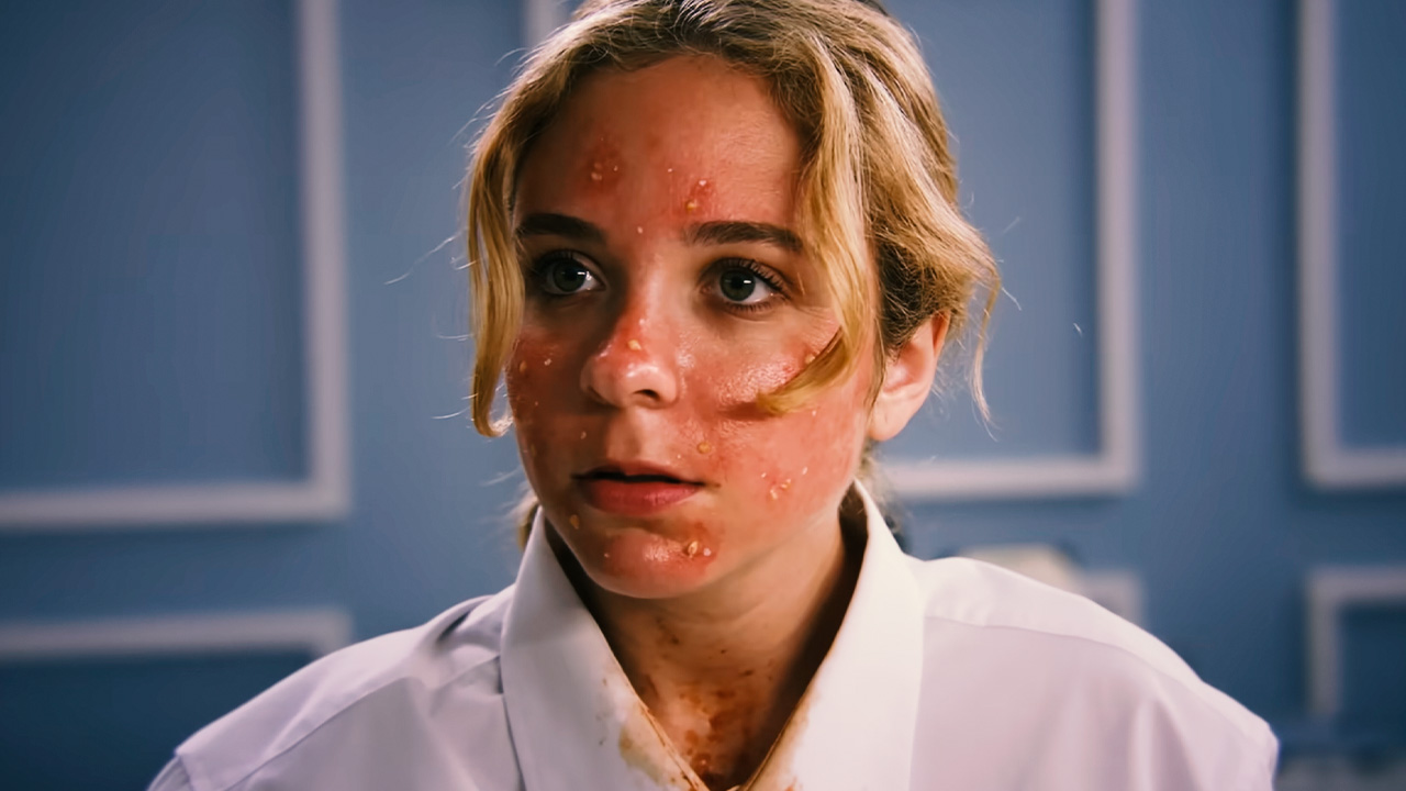 Shamed by a rude customer for having acne?