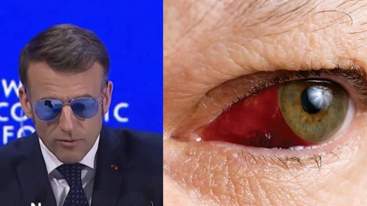Emmanuel Macron’s indoor sunglasses at Davos spark concern: What is ...