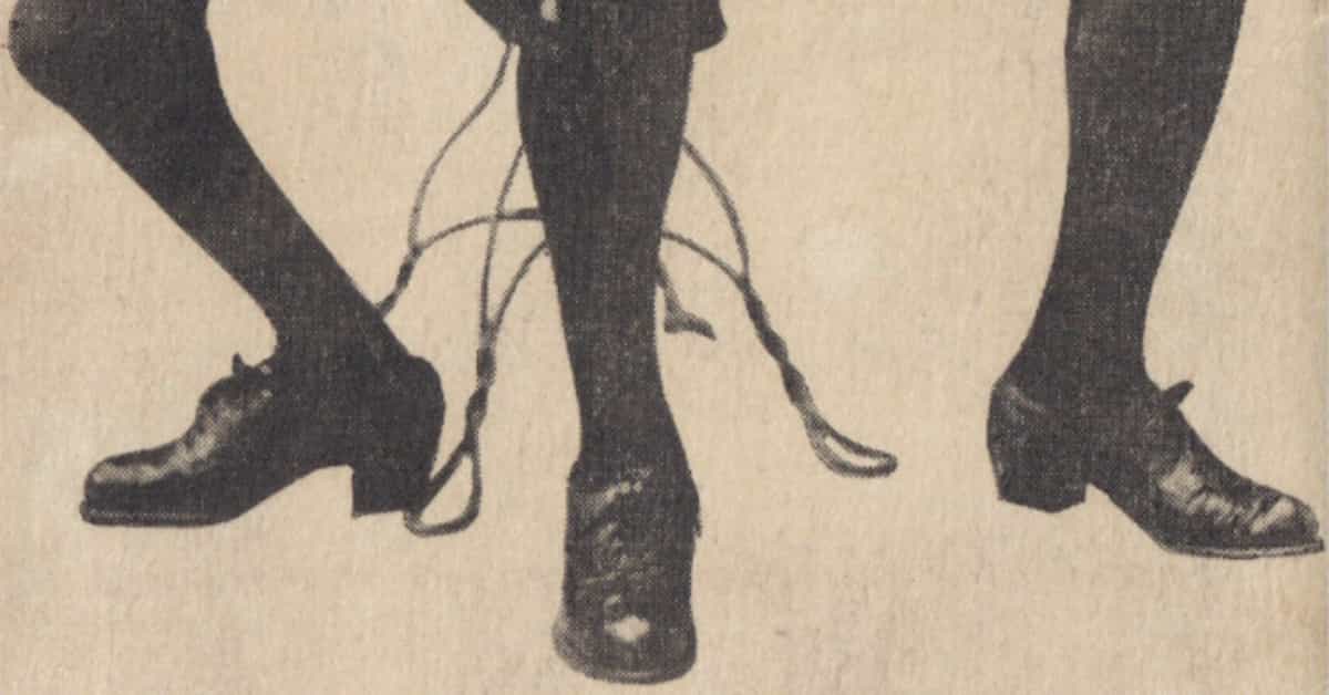 Facts and stories about Frank Lentini, the 'three-legged man'