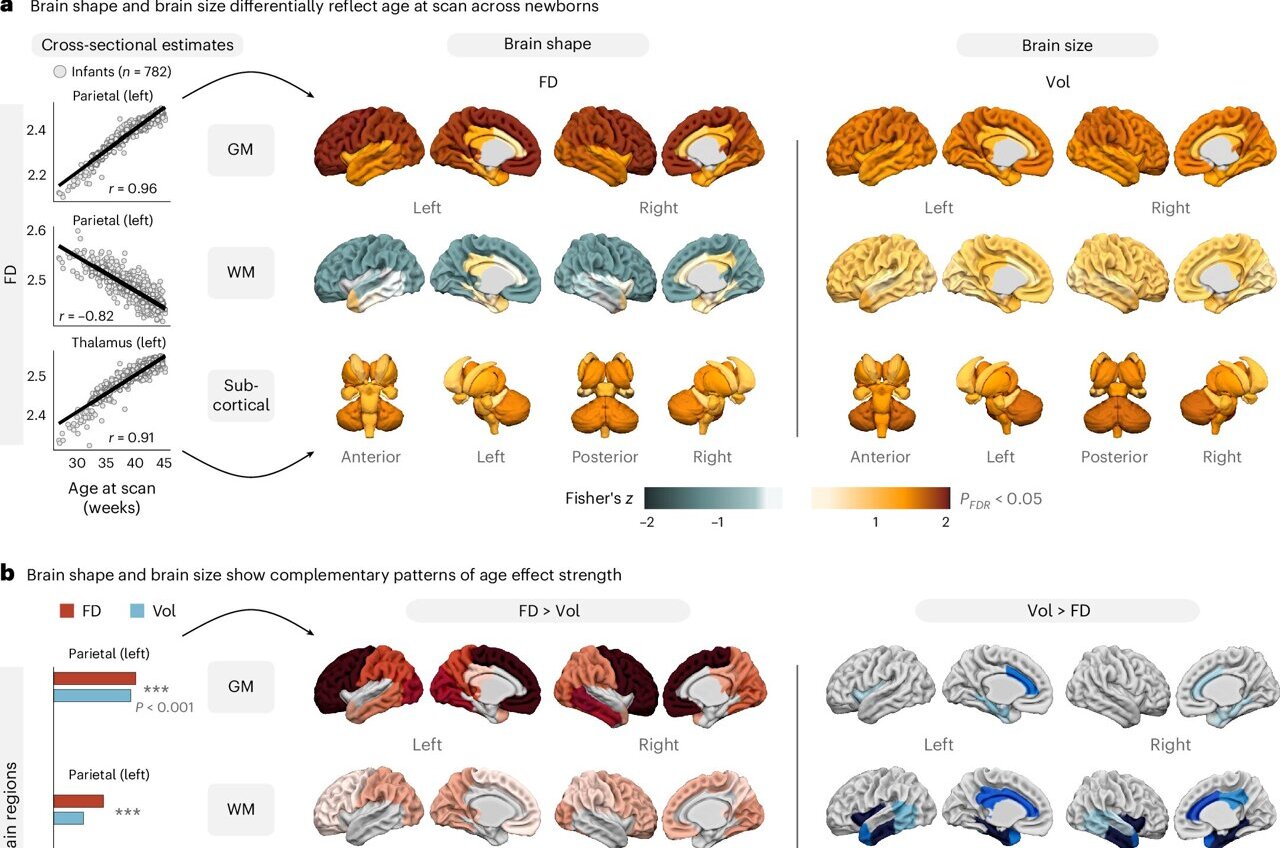 What the brain's shape and complexity say about a newborn's development