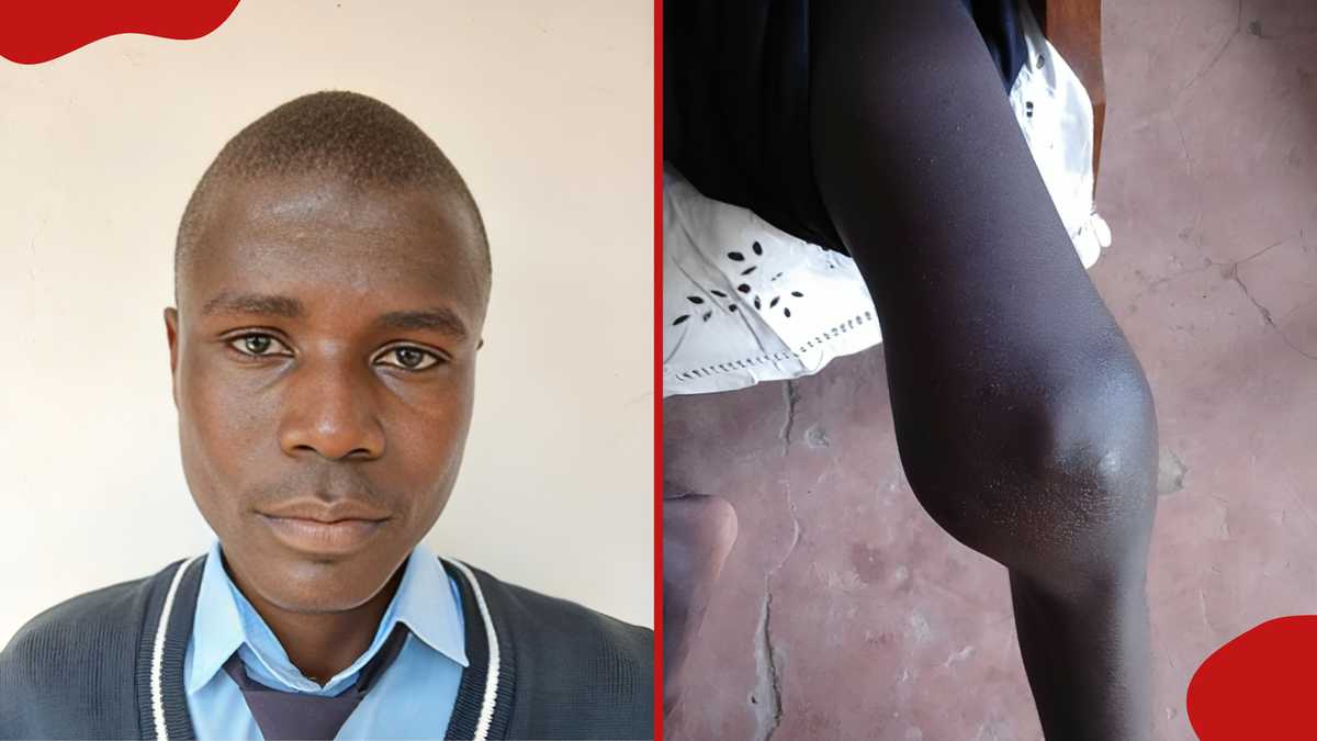 Kisumu dad working at Jua Kali seeks KSh 50k to treat Form 4 son's ...