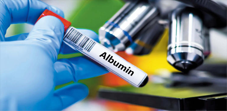 Medical experts label albumin product promotions 'nationwide fraud'
