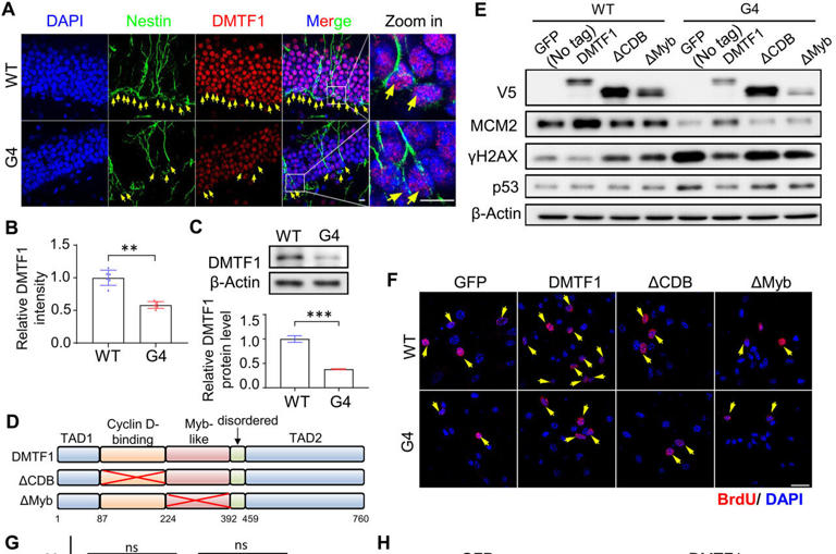 Key protein can restore aging neural stem cells' ability to regenerate