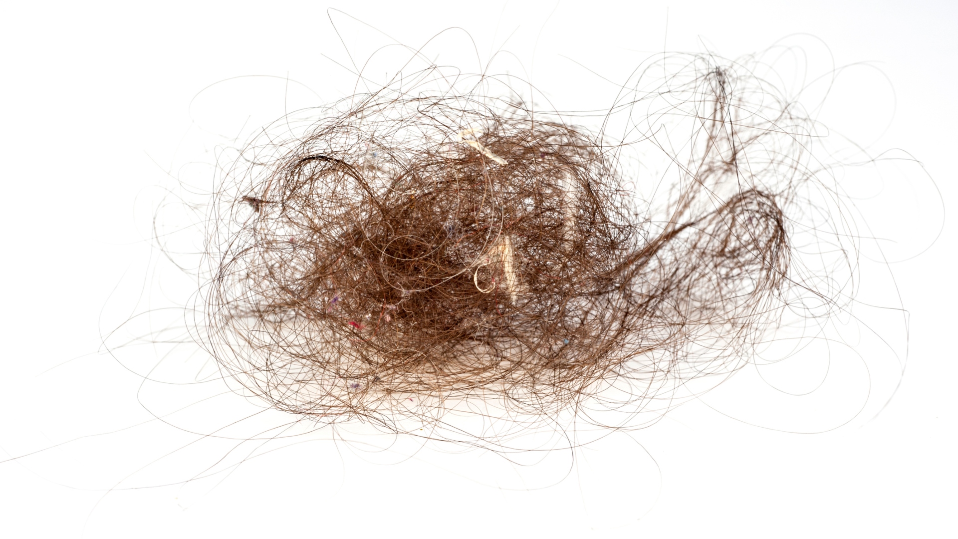 Doctors discover meter-long hairball in the stomach of 9-year-old girl ...