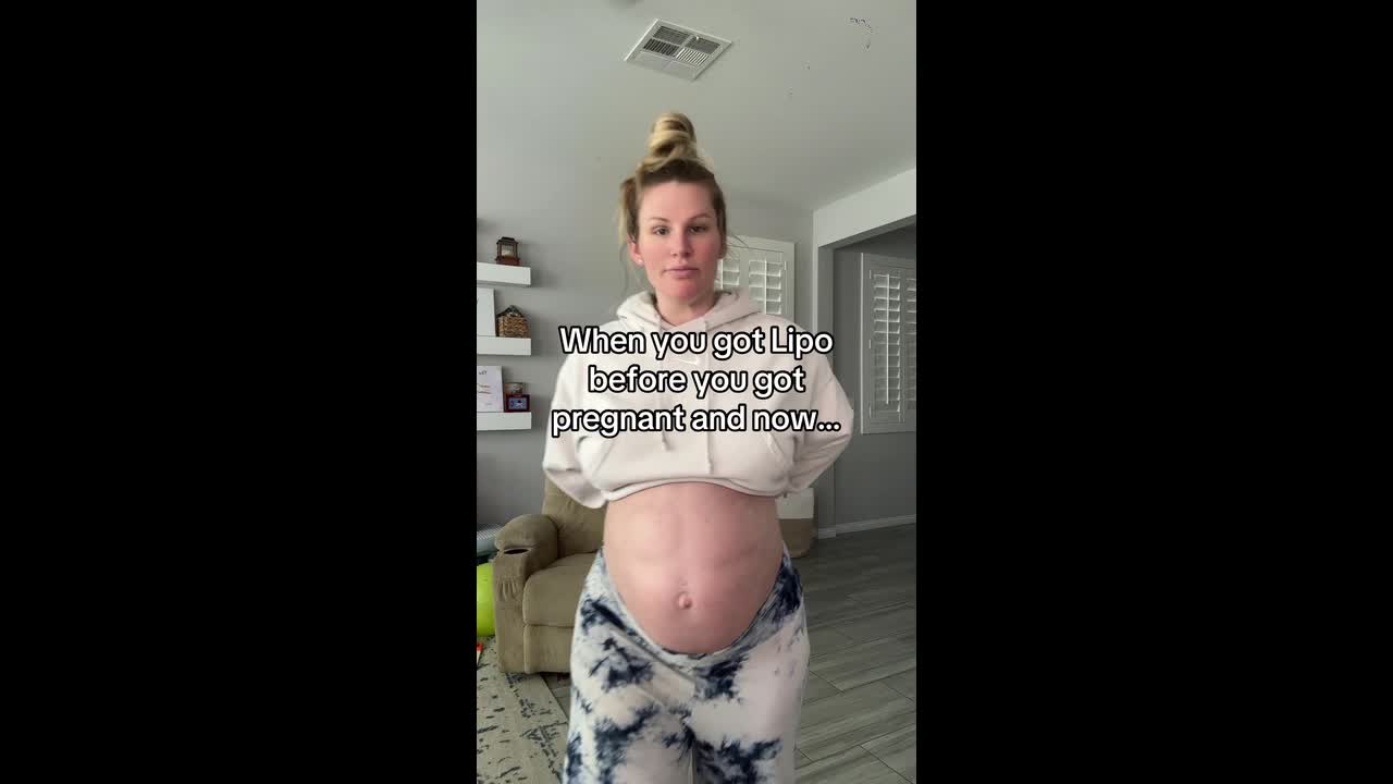 'Turtle shell' baby bump goes viral as mum shows unusual 38‑week ...