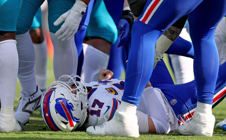 Bills’ Josh Allen may need surgery after crushing playoff loss