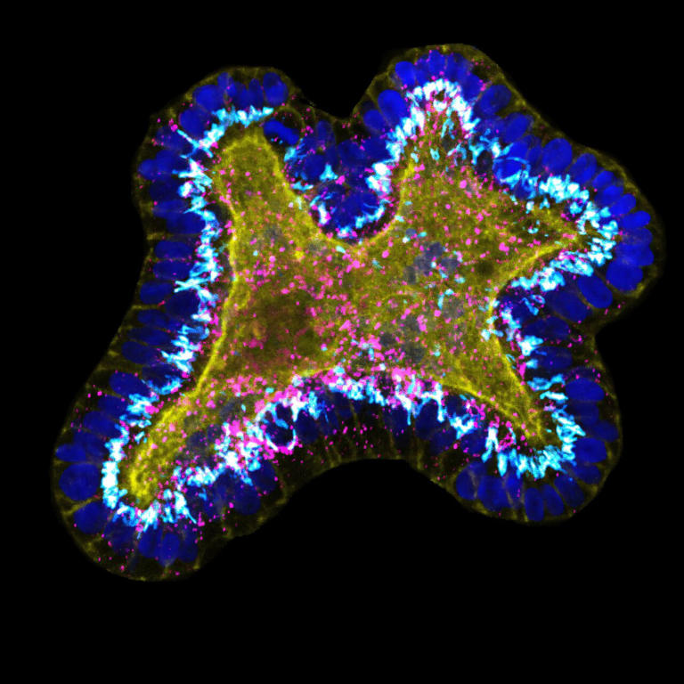 New method creates acinar cells involved in formation of pancreatic cancer