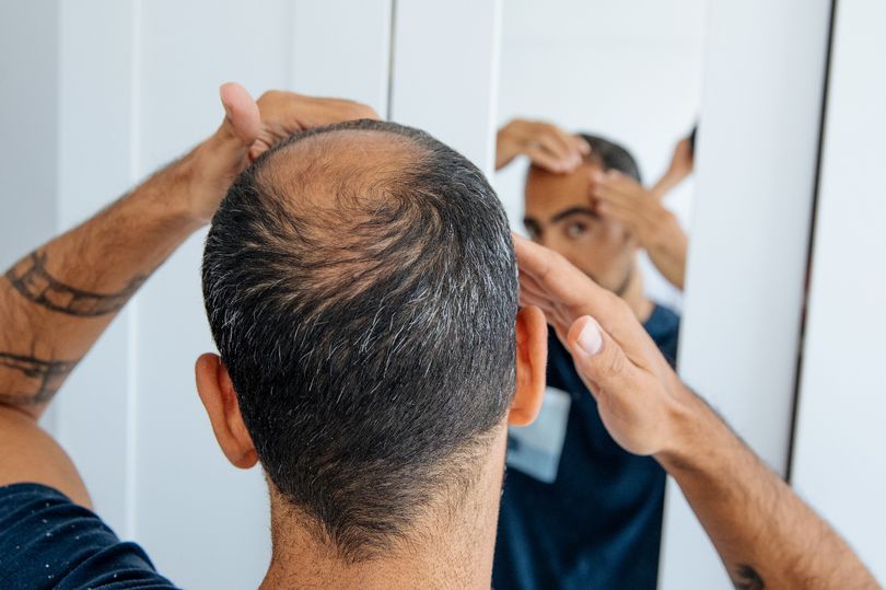 Experts expose disgusting ancient way of using human waste to cure baldness