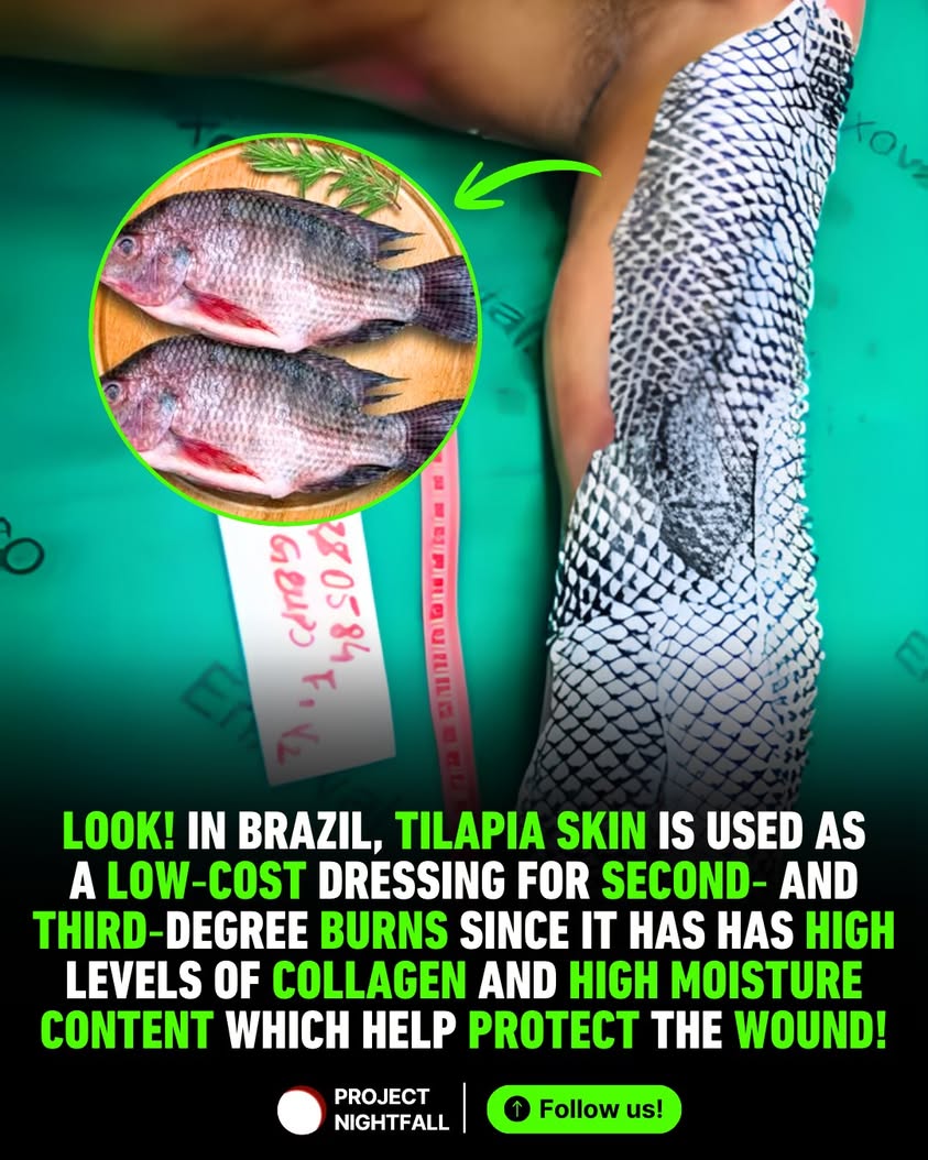Wow! Tilapia for your wounds? 🤯🐟 In Brazil, sterilized tilapia fish ...