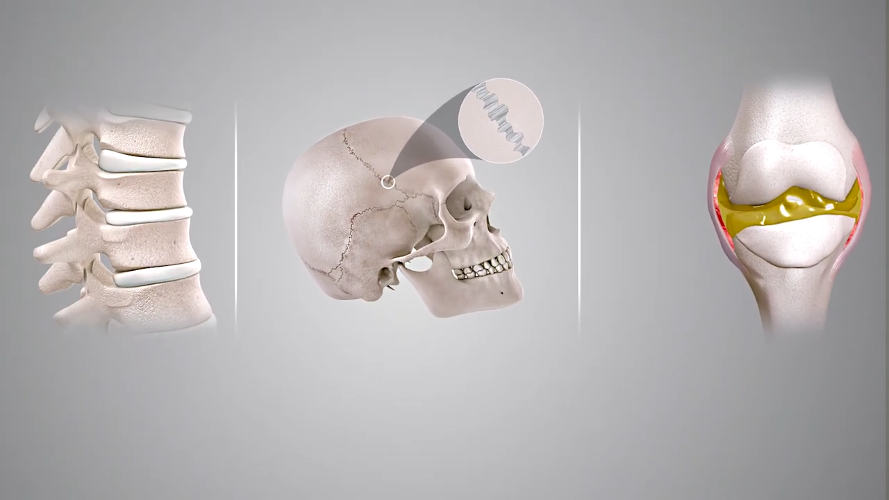 This myth won’t go away – an arthritis specialist explains whether ...