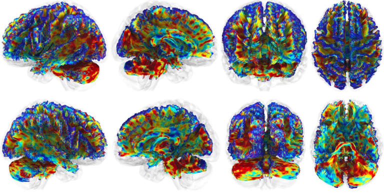 Red light therapy shows promise for protecting football players' brains