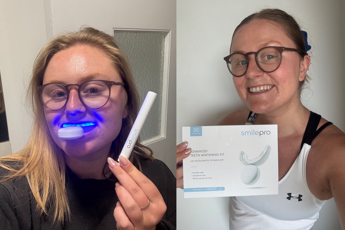 This whitening kit brightened my teeth in just 30 minutes