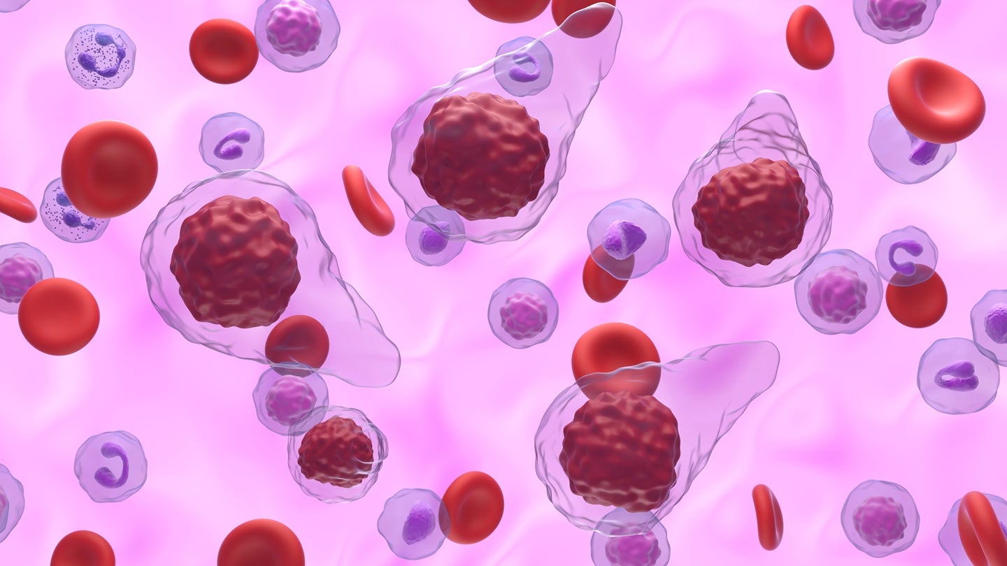 Opna Bio’s OPN-2853 secures FDA’s orphan drug status for myelofibrosis