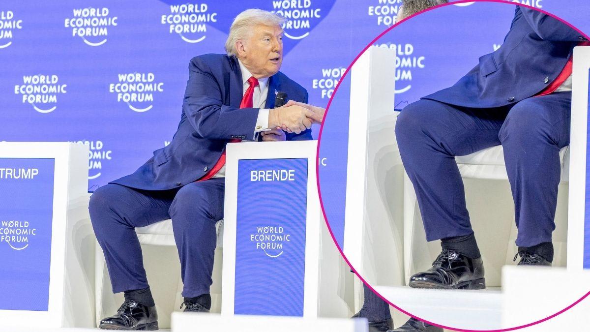 Unwell Donald Trump mocked for showing his massive cankles at World ...