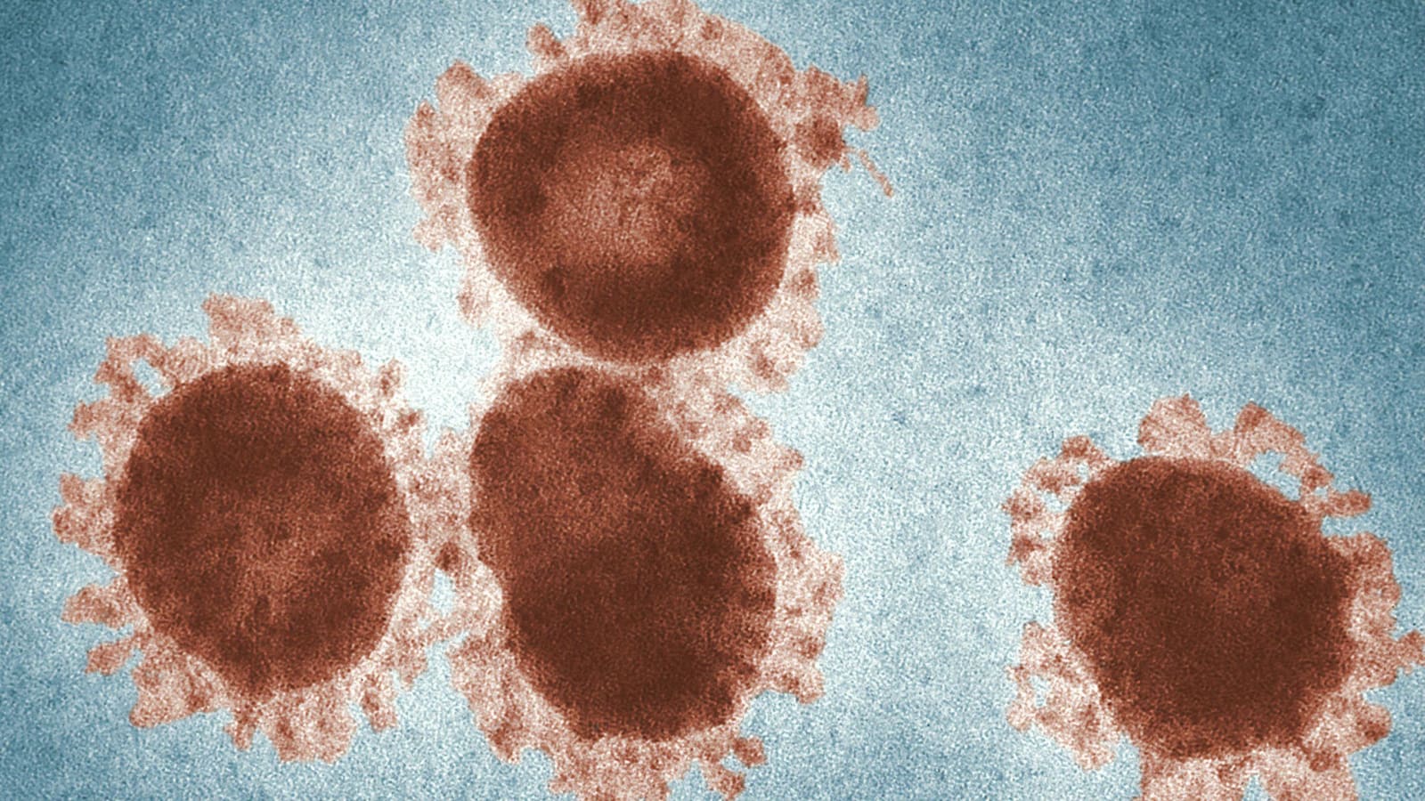 Nipah virus less contagious, but more deadly than COVID-19: Symptoms ...
