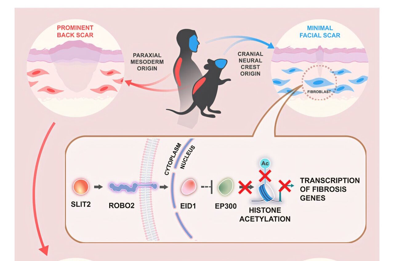 The face scars less than the body: Study explains why