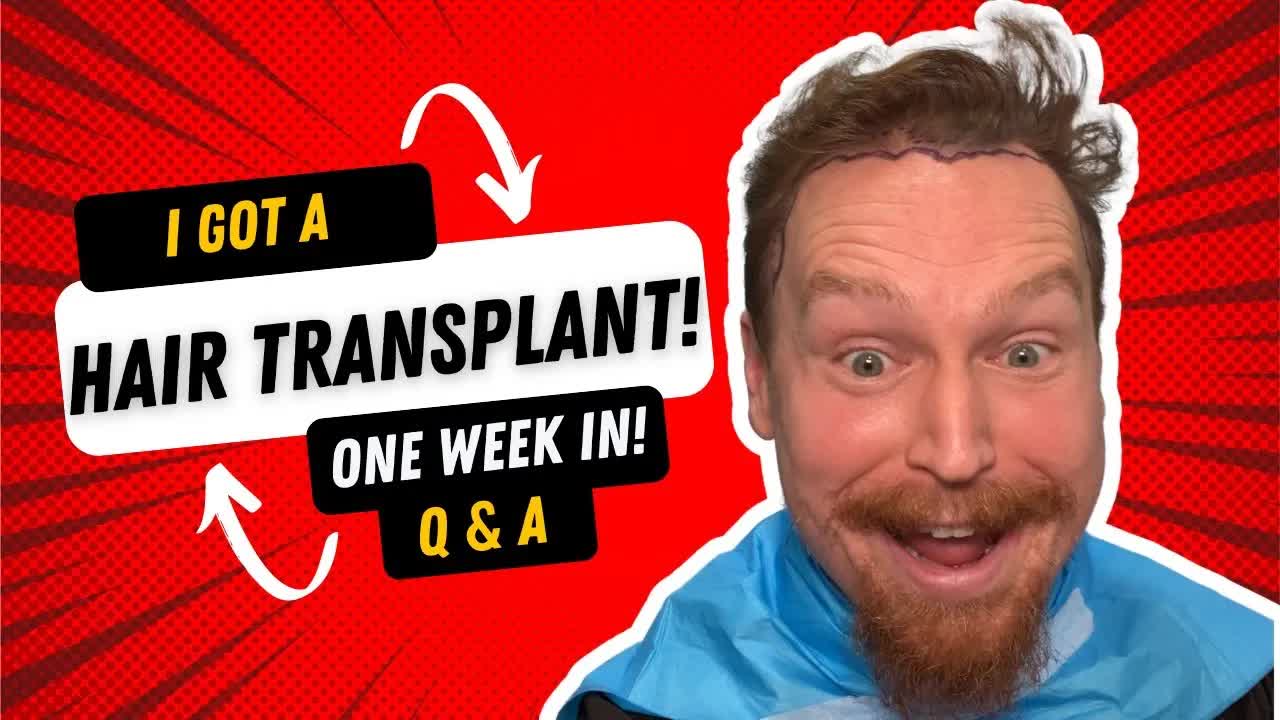 I got a HAIR TRANSPLANT! 7 Days Later QnA (Do's and Don'ts Week 1)