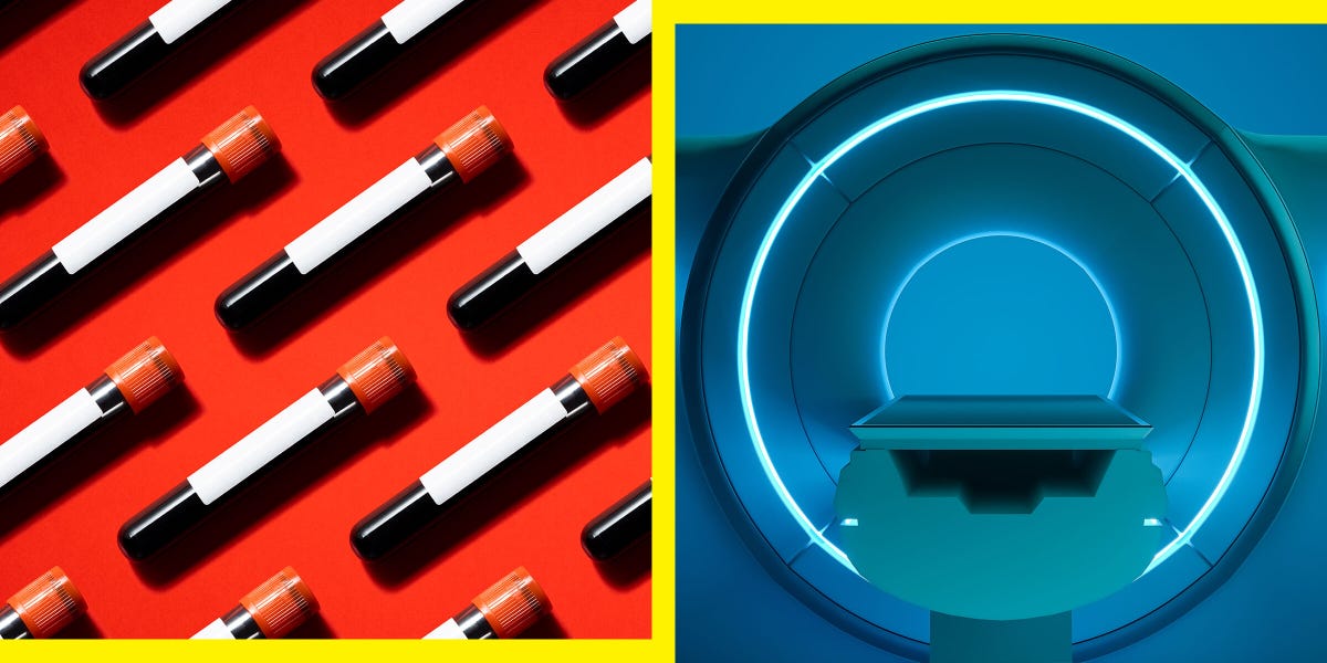 Full-body MRI vs. blood test: Which is better for detecting cancer?
