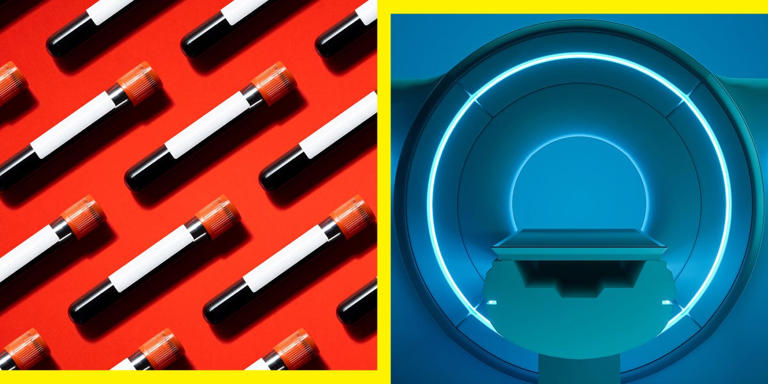 Full-Body MRI vs. Blood Test: Which Is Better for Detecting Cancer?