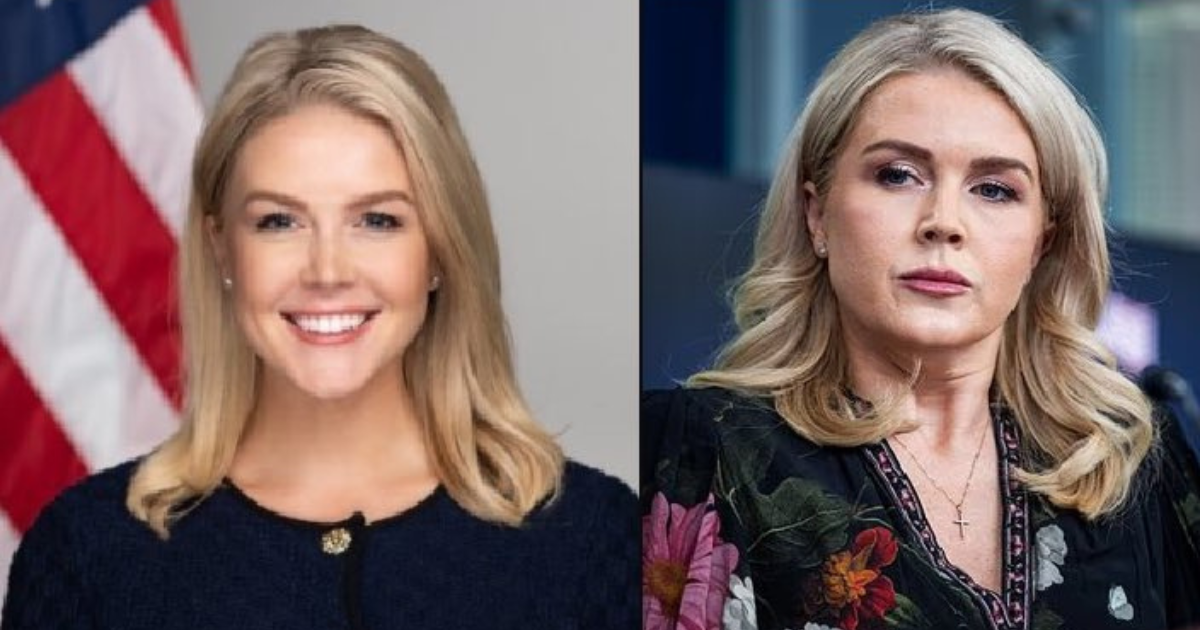 Karoline Leavitt’s transformation pics spark plastic surgery rumors ...